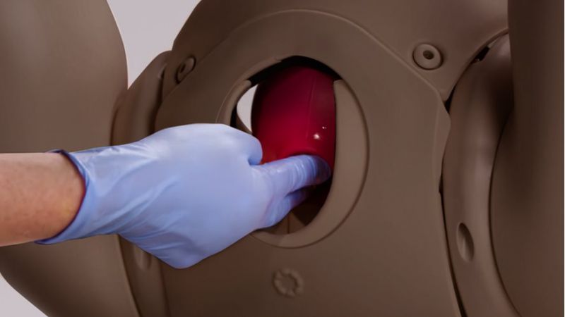 2 cm dilated 75 effaced